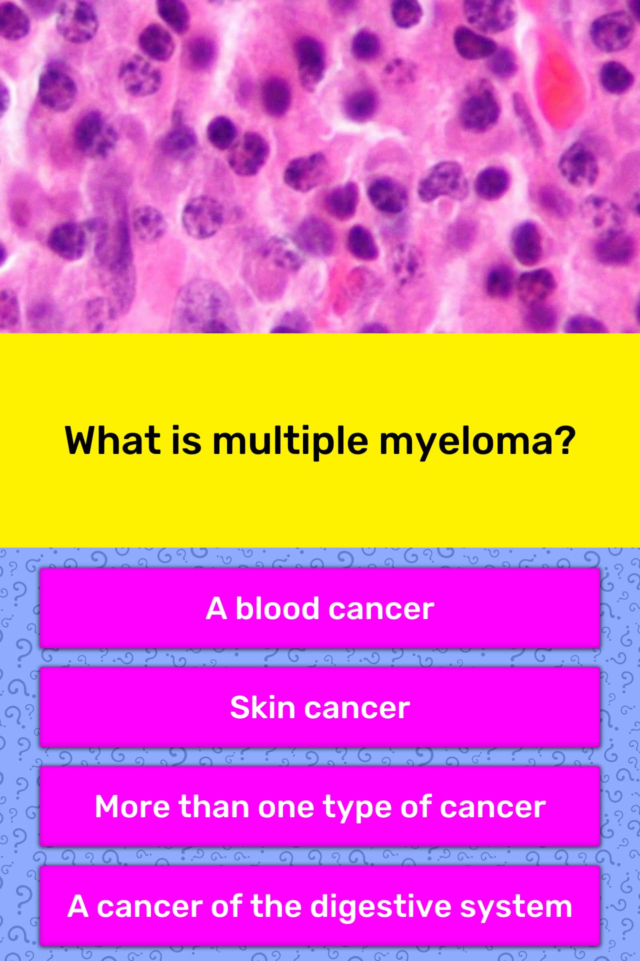 What Is Multiple Myeloma Trivia Answers QuizzClub